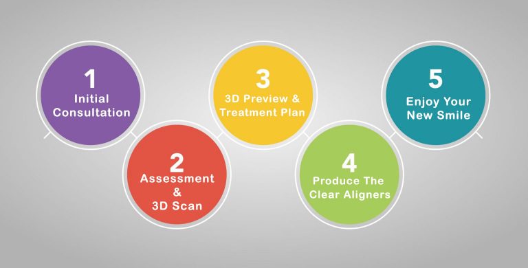 Active Aligners – Ilford Dental Care